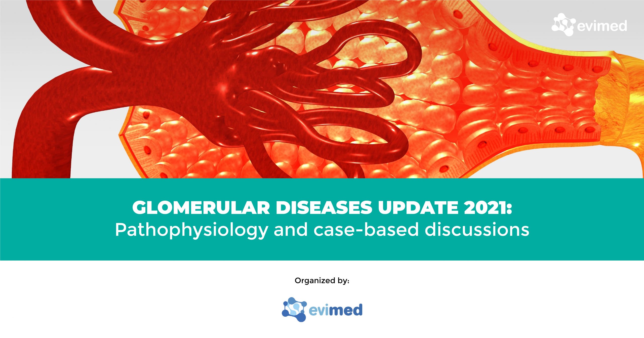 Autogestionado: Glomerular Diseases Update 2021: Pathophysiology and ...