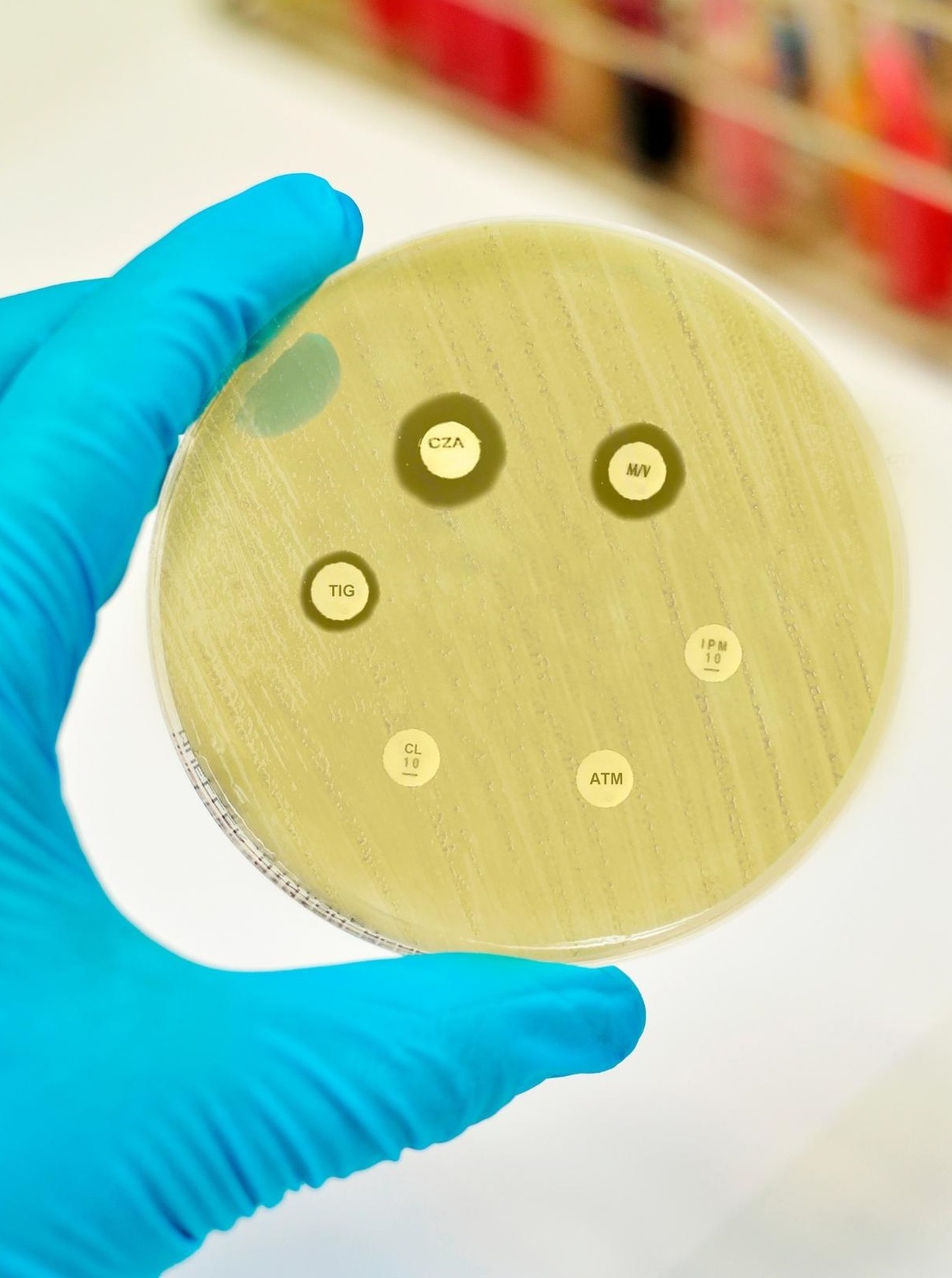 Interpretación del Antibiograma 2023: del laboratorio a la práctica clínica
